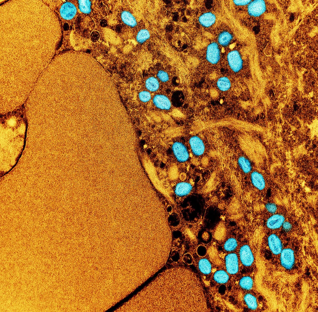 LJI scientists lead new mpox research – lji.org