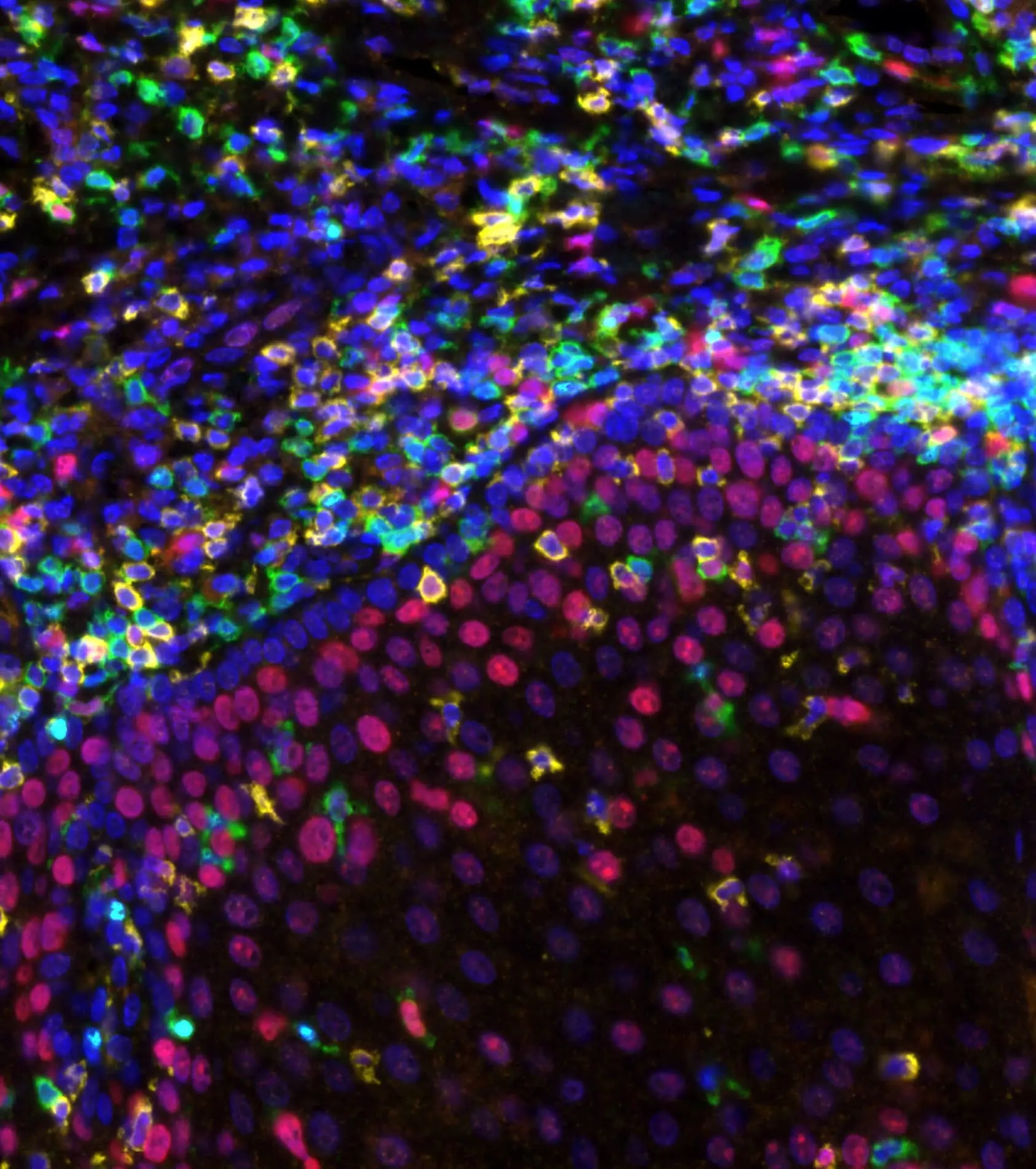 A step toward personalized immunotherapy for all – lji.org