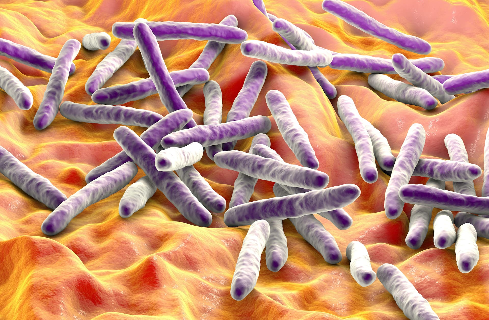 Immunologic defect may leave some vulnerable to rare bacterial ...