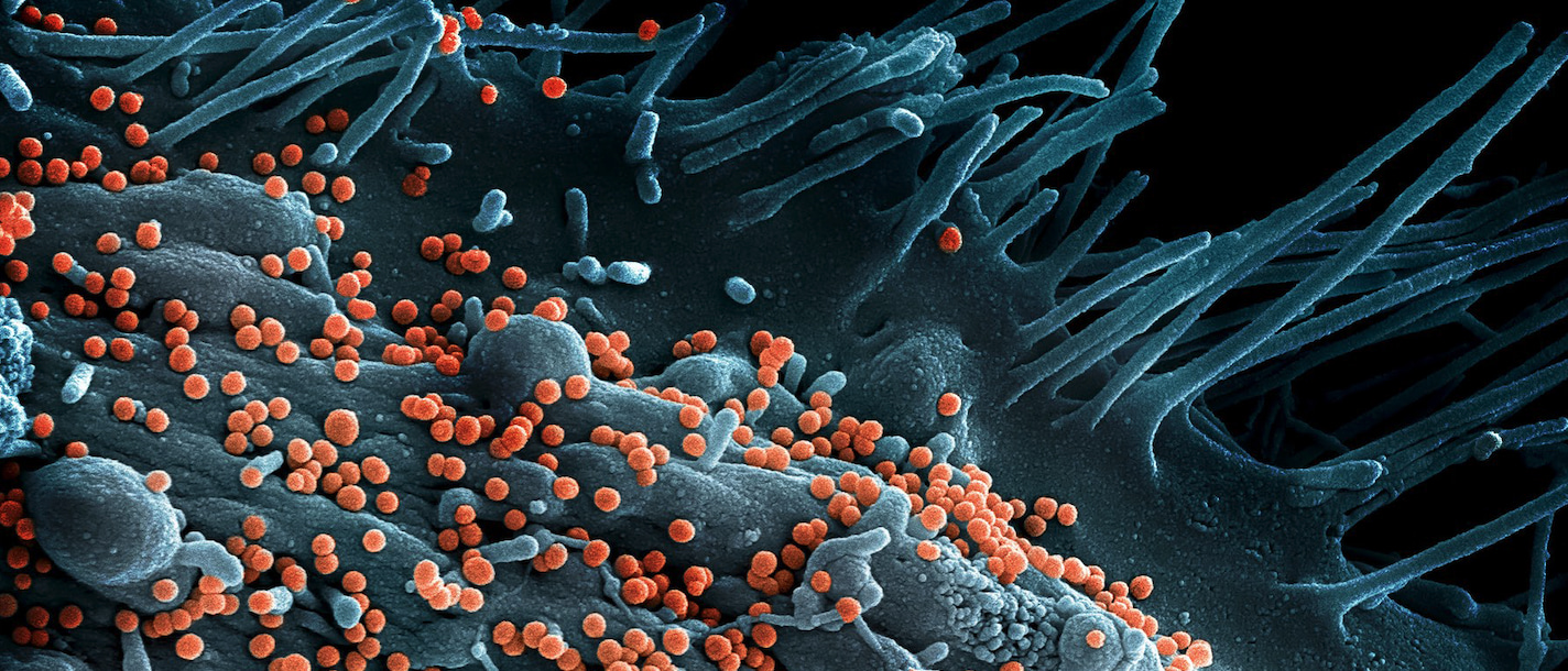 LJI scientists discover clue to stopping Lassa virus infection – lji.org