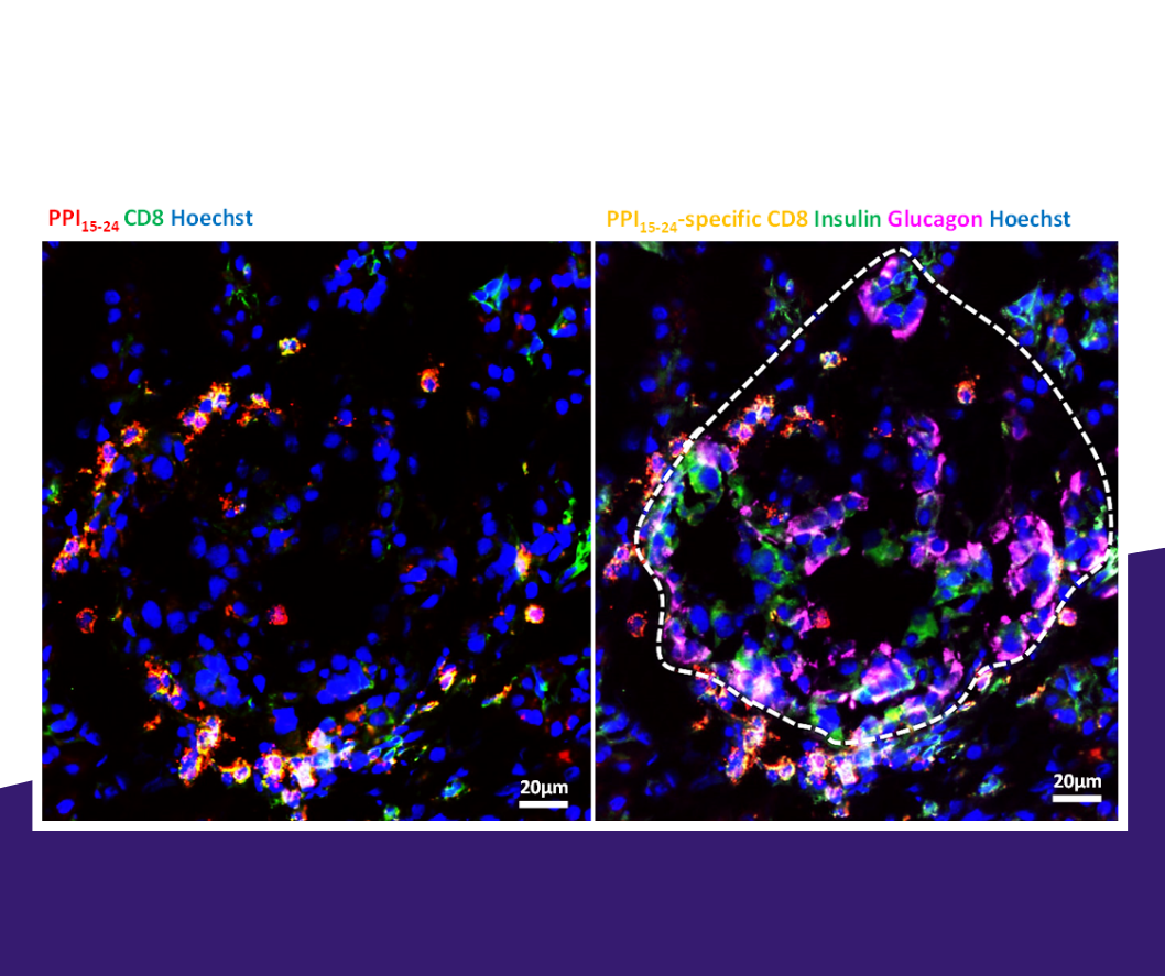 The story behind a vivid pancreas image – lji.org