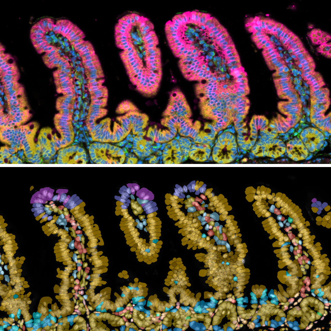 Mapping immune cell battles – lji.org